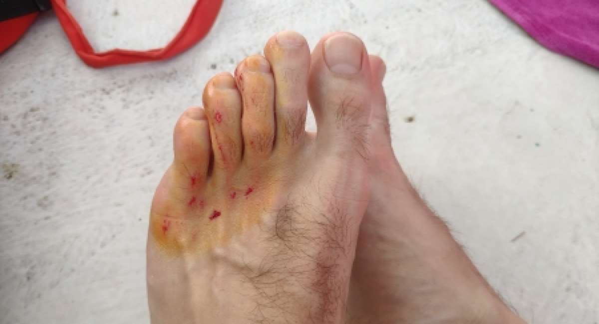 Koh Tao : Attaqué par un poisson Baliste Titan à Koh Tao